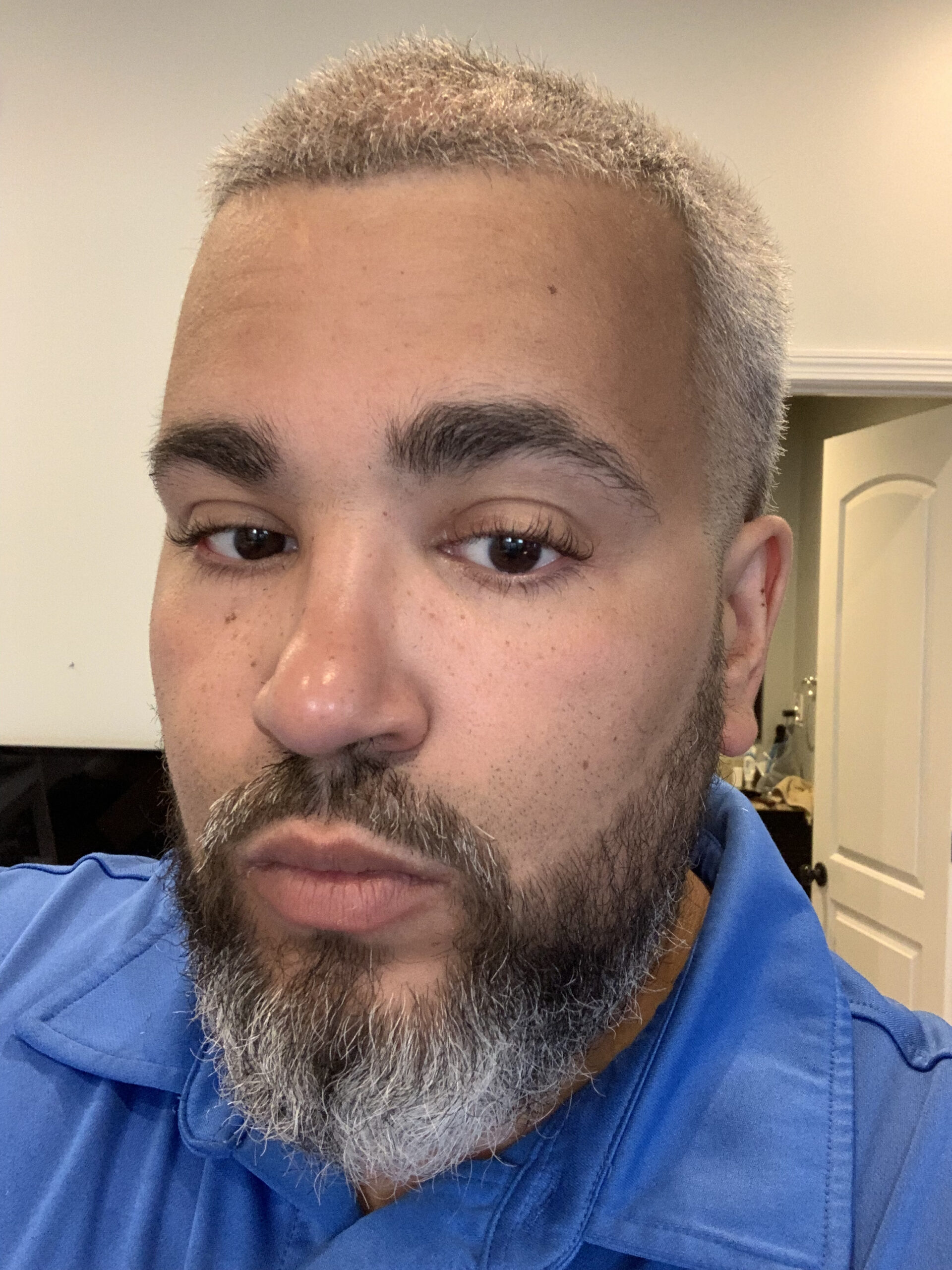 The Power of Lived Experience: Why Peer Support Is Essential for ...